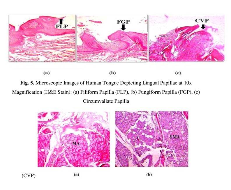 Fig. 6. MicroscopicImages of Human Tongue Depicting Lingual Glands at ...